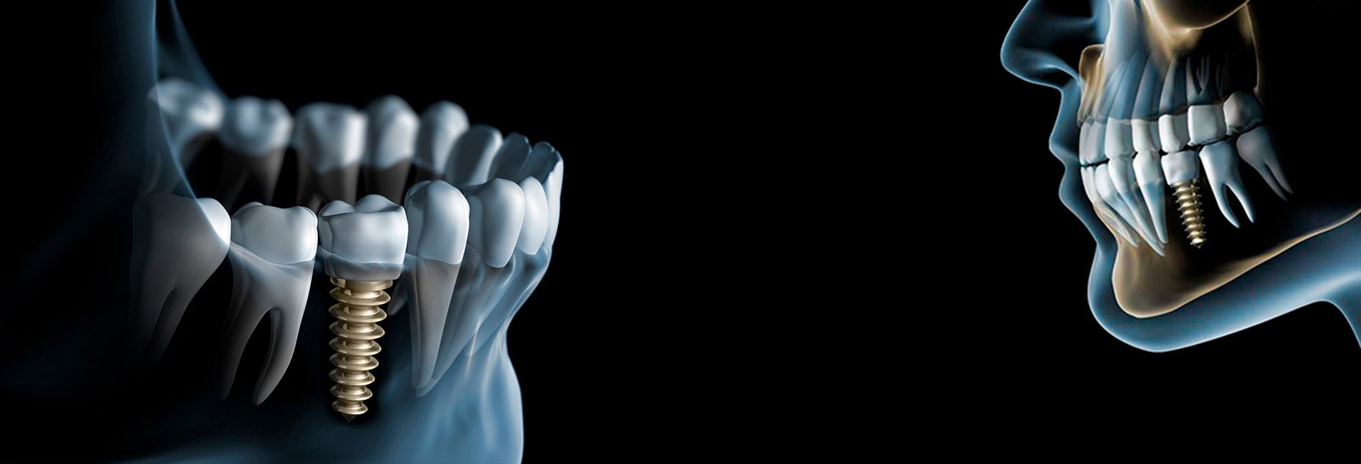 profident – стоматологічна клініка Київ